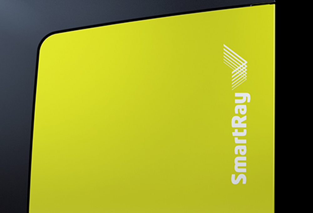 SmartRay ECCO75 – High-Precision 3D Sensor for Industrial Quality ...